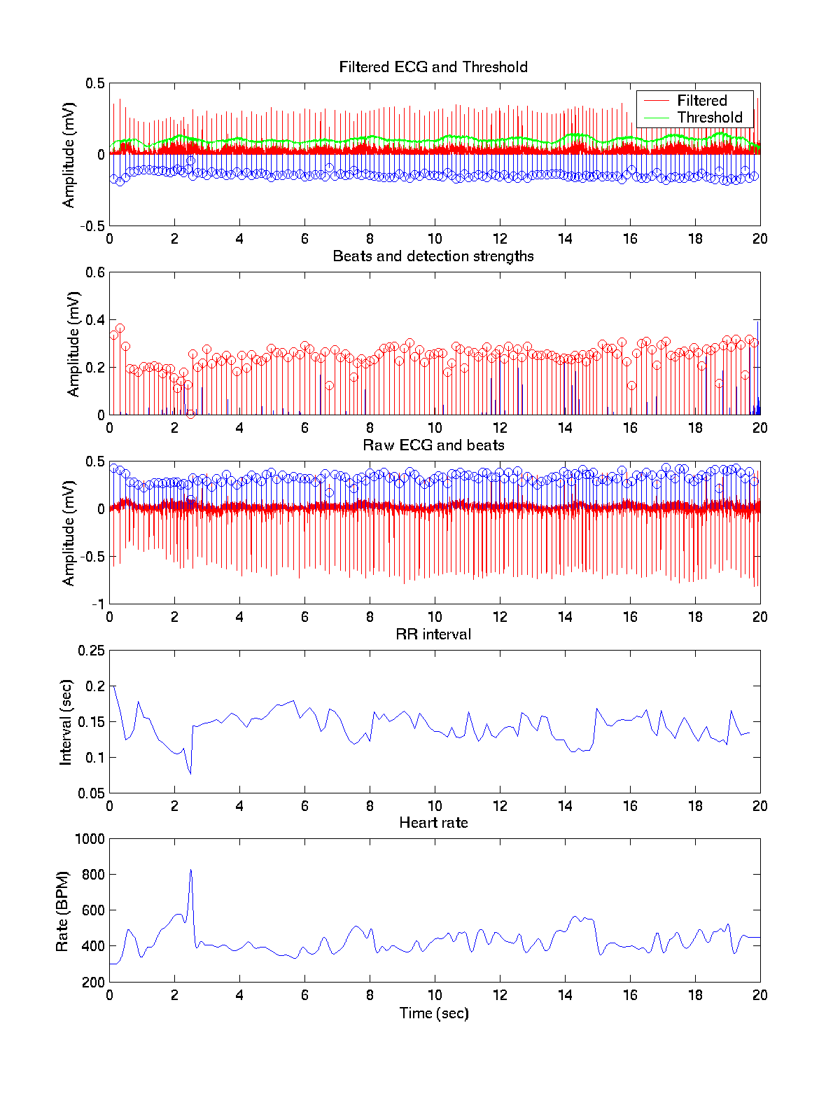 Adaptive Filters Applied to Heart ECG