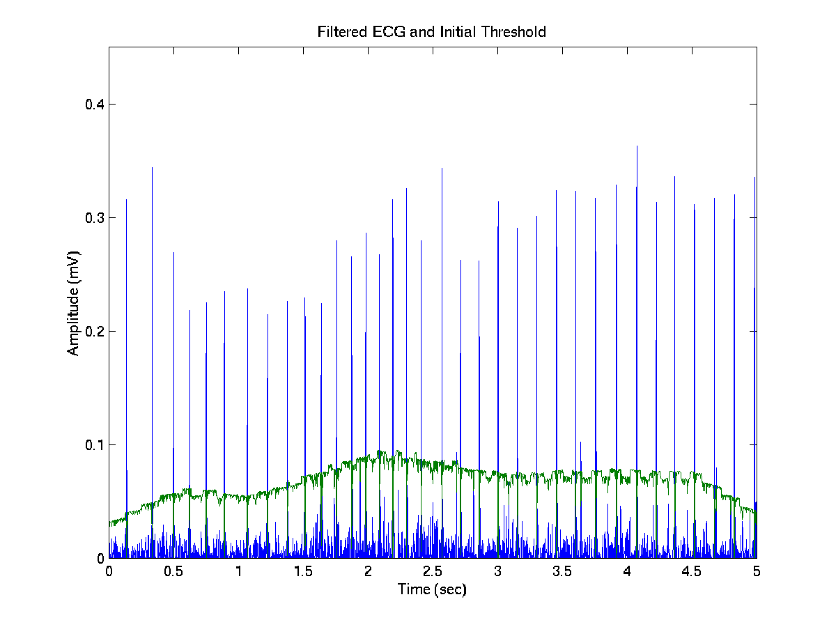 Adaptive Filters Applied to Heart ECG